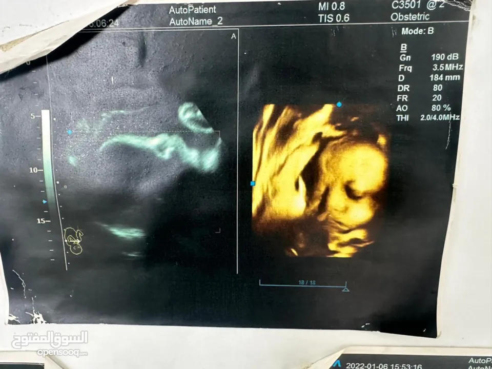 TH-5500 Full-digital color doppler ultrasound diagnostic system ...