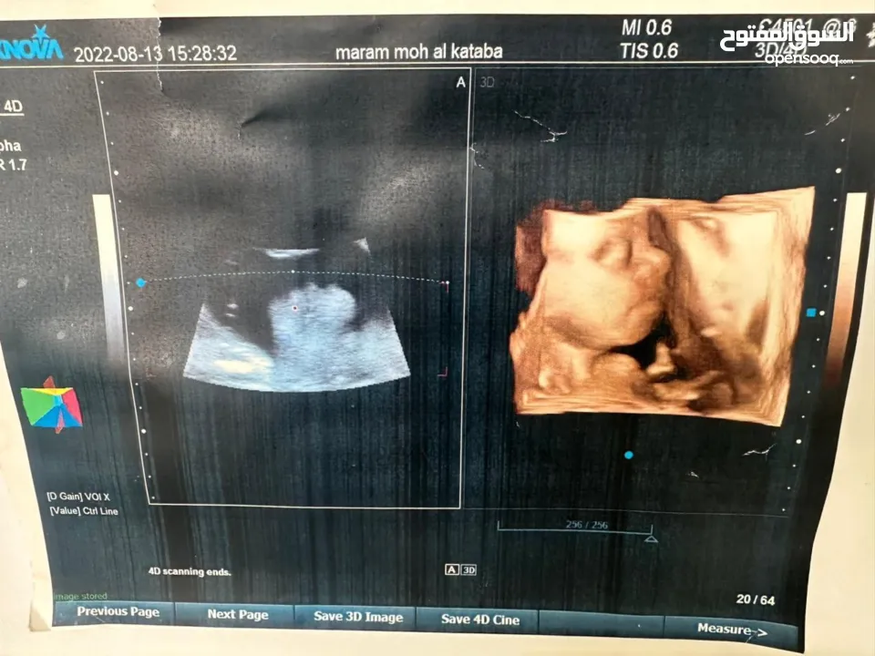 TH-5500 Full-digital color doppler ultrasound diagnostic system ...