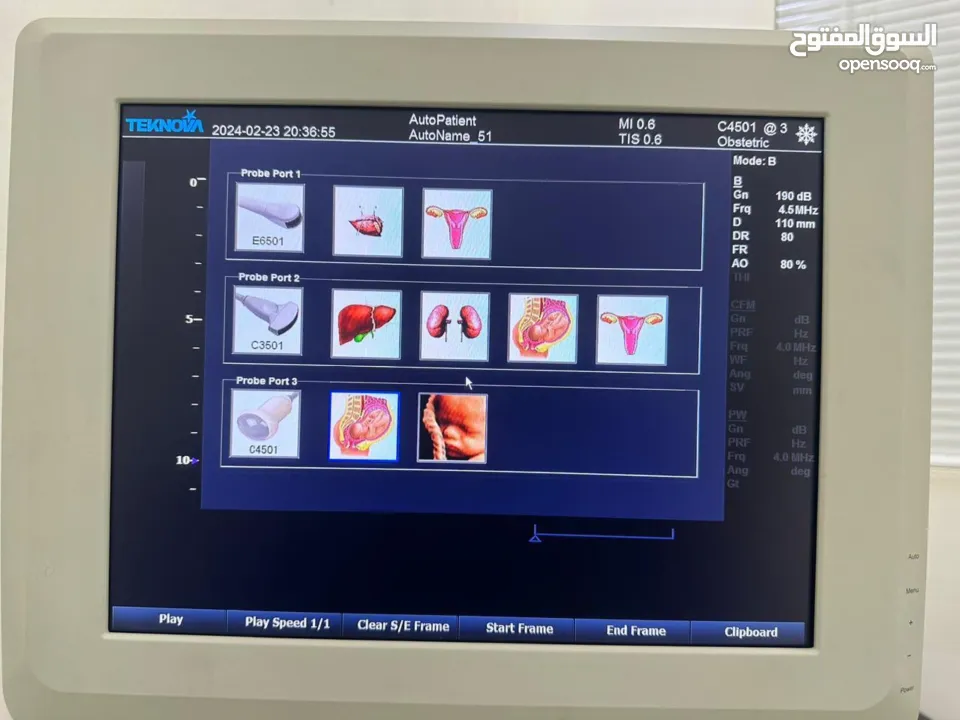 TH-5500 Full-digital color doppler ultrasound diagnostic system ...